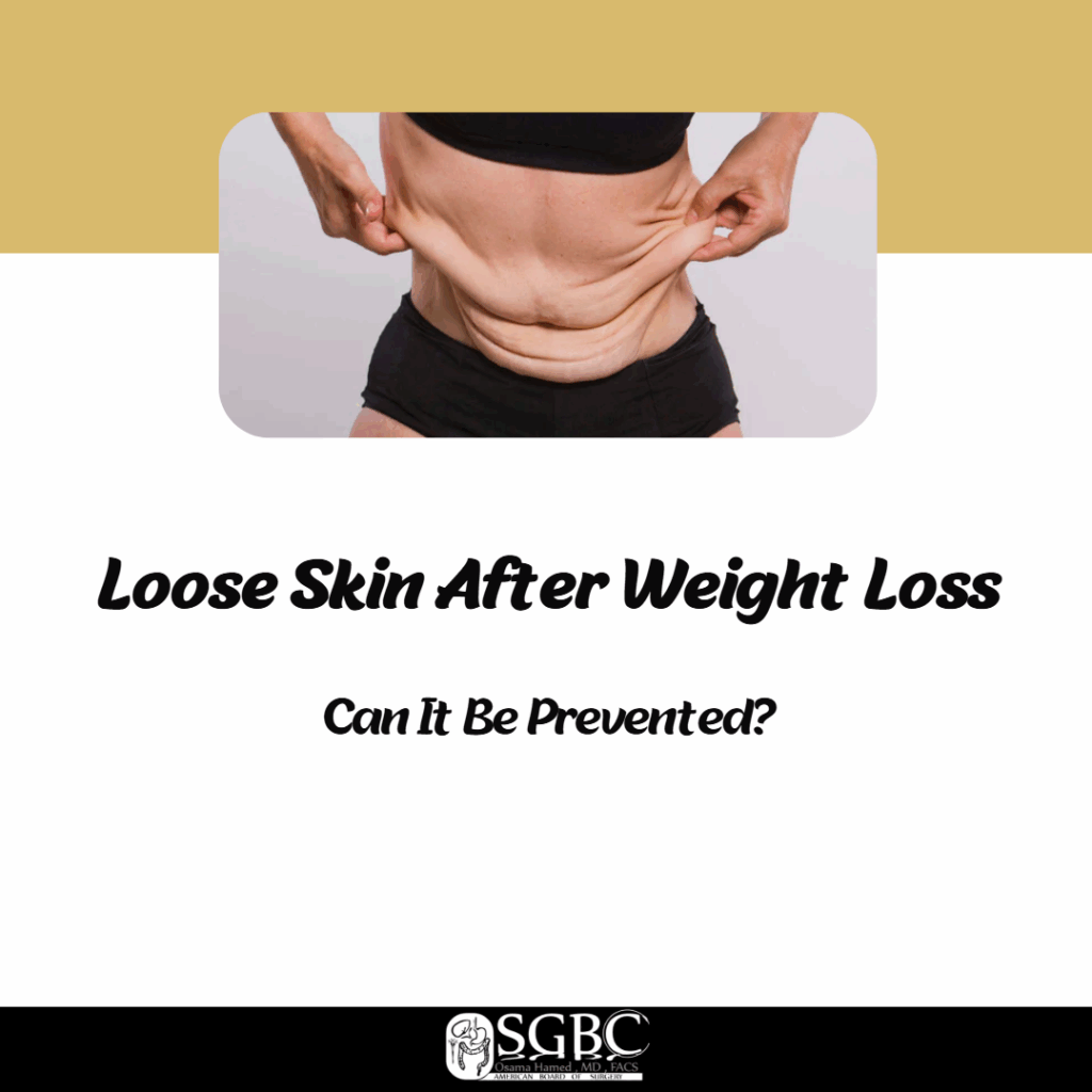 Loose Skin After Weight Loss: Can It Be Prevented? - SGBC Clinic
