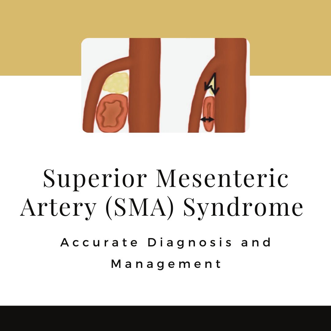 Superior Mesenteric Artery Syndrome Symptoms